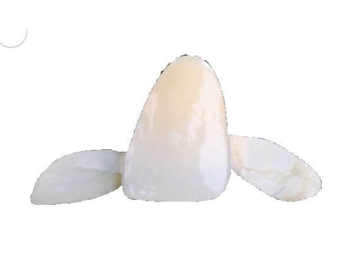 MARYLAND BRIDGE ZIRCONIA WING - Lavina
