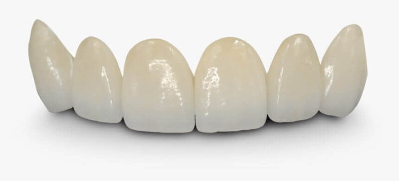 ZIRCONIA LAYERED - Lavina