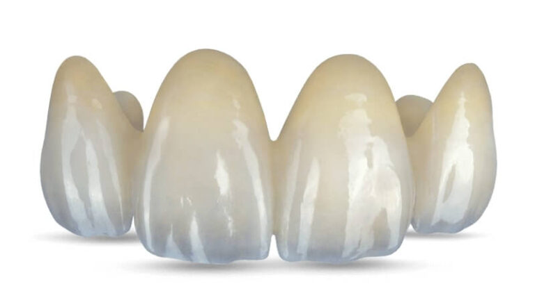 FULL ZIRCONIA 3D MULTILAYER - Lavina